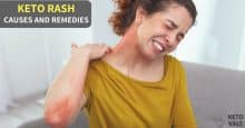 Keto Rash: Causes, Remedies and How To Prevent